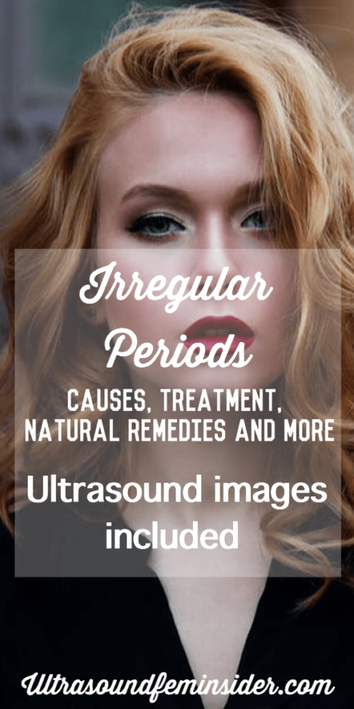 Irregular periods. Causes, treatment, natural remedies, ultrasound and ...