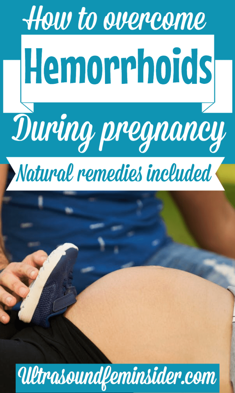 Tips To Prevent Or Treat Hemorrhoids During Pregnancy