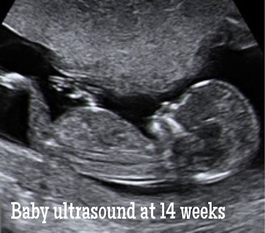 First Trimester Baby Development by Week. - Ultrasoundfeminsider